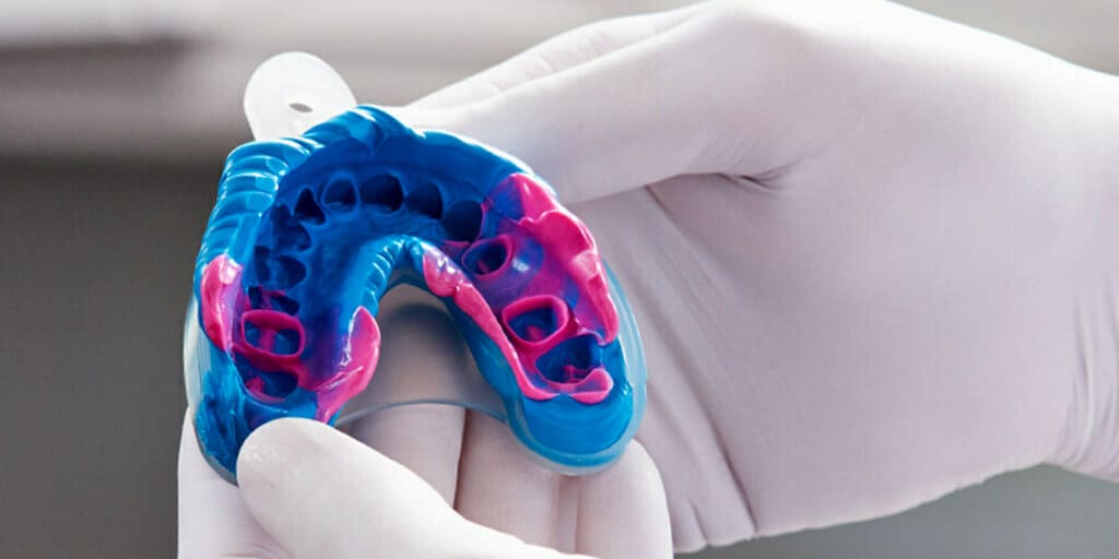 Impressions Dental Saving Time And Money With The Right Impression