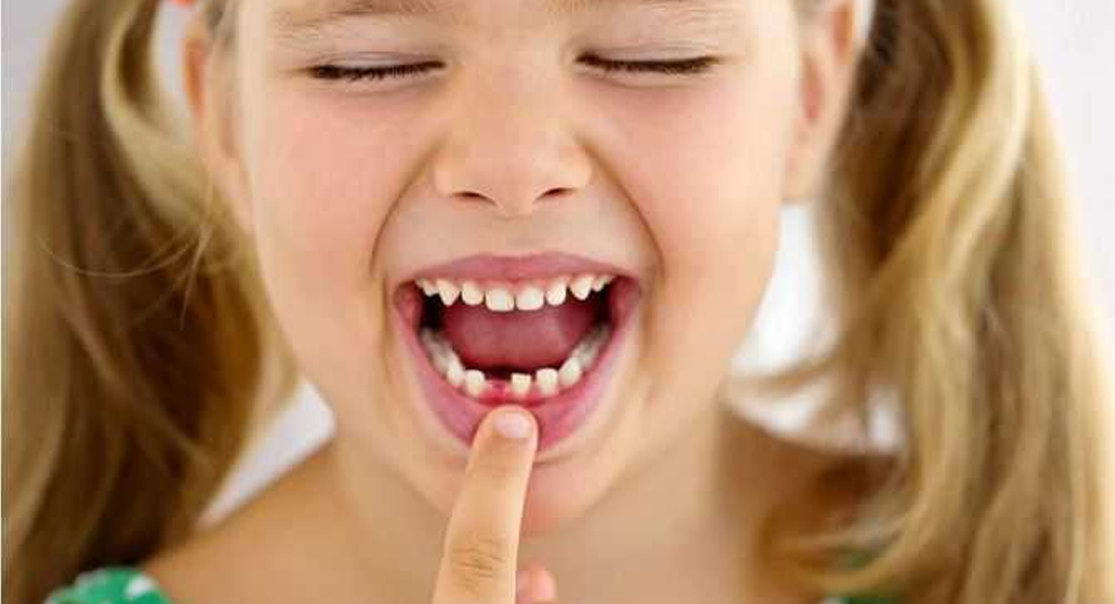 What to Know About Eruption of Child's Permanent Teeth - UDENZ - MENA ...